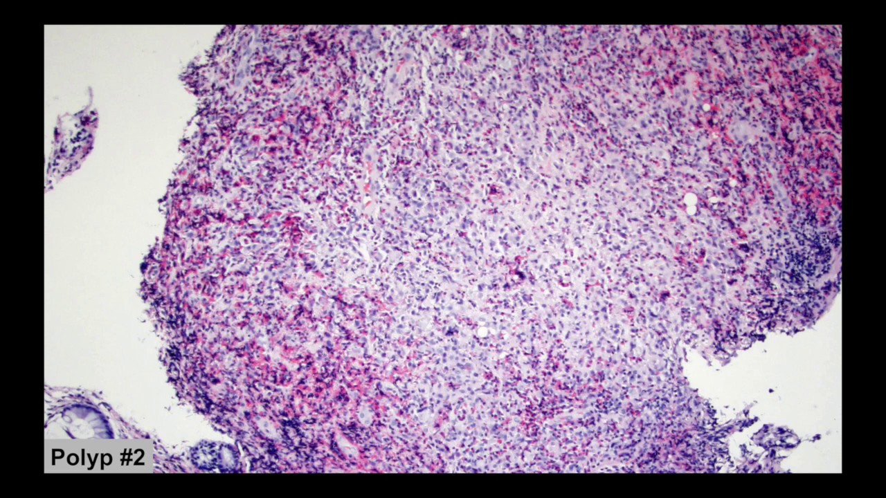 Cases with Dr  Keeney: Case #3
