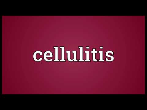 Cellulitis Meaning