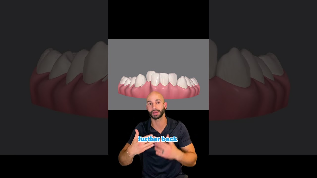 Invisalign Before and After Timelapse. 2023