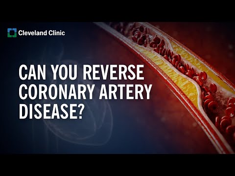 Can You Reverse Coronary Artery Disease?