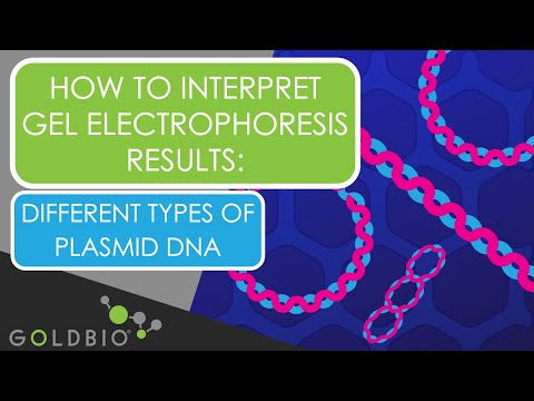 How to Interpret Gel Electrophoresis Results: Different types of plasmid DNA