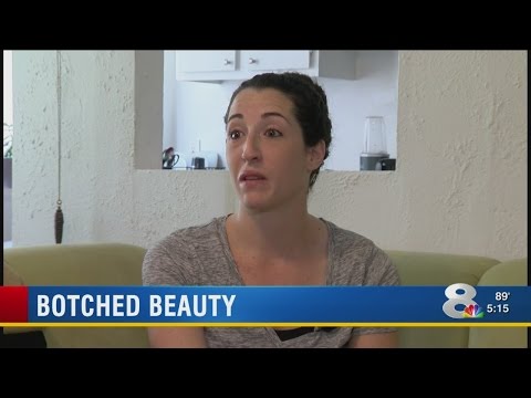 Tampa Woman Warns: Inexpensive plastic surgery overseas can lead to botched 'do-overs'