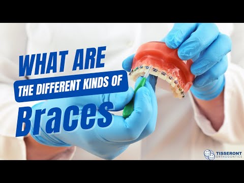 What are the Different Types of Braces and What Do They Do?