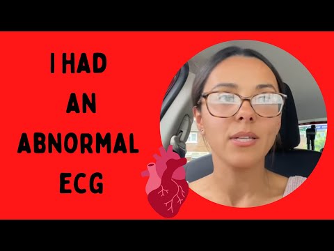 Have you had an ABNORMAL ECG? Watch this!