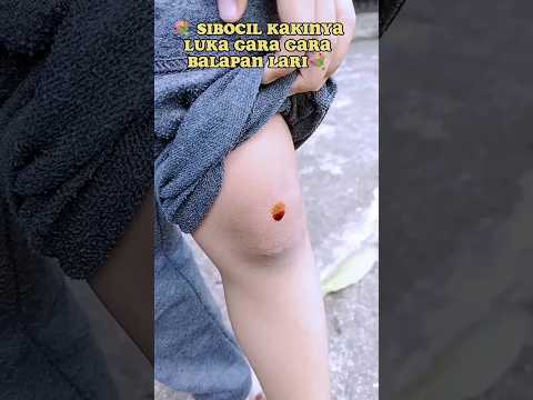 Sibocil kaki nya luka gara gara balapan lari_Mama & agra #badut #eskrim #mainan #hantu #yupi