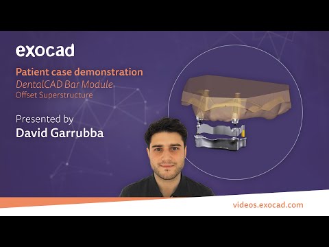 Patient Case Demonstration (5/6): DentalCAD Bar Module (Offest Superstructure)