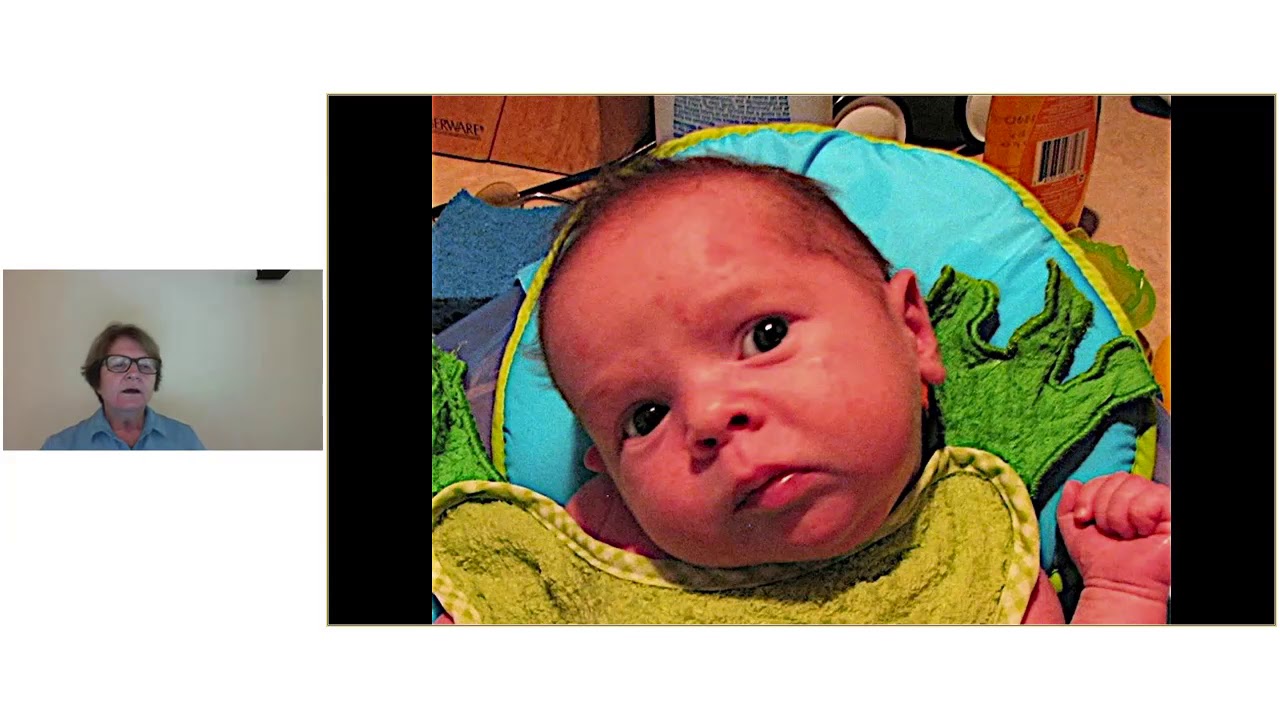 Dr. Miles - The Changing Faces of Torticollis