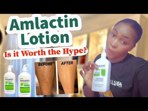 Amlactin 12% Lactic acid Lotion Review | What it really does for you /How to use Amlactin Lotion