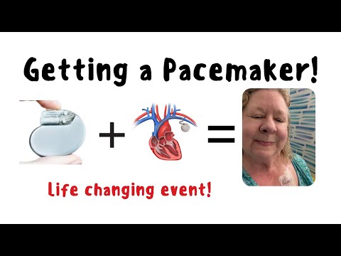 Getting a Pacemaker! A Life Changing Event!