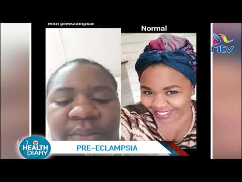 Understanding pre-eclampsia || Health Diary