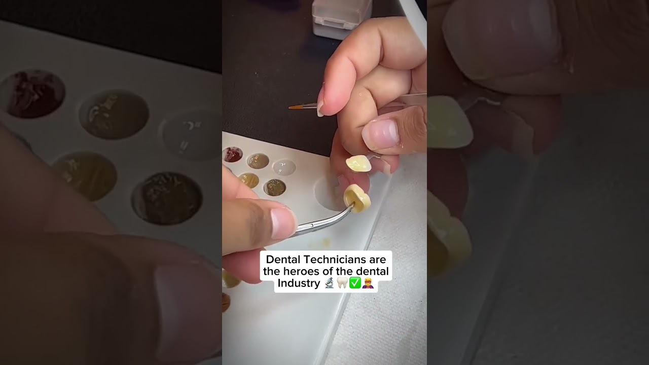 Dental Technicians are truly the heroes of the dental industry 🦷🔬✅