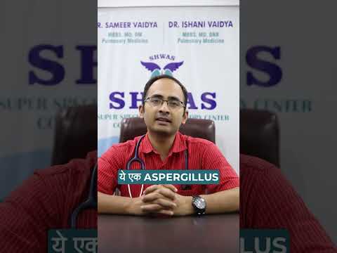 Allergic Bronchopulmonary Aspergillosis (ABPA) - Dr Sameer Vaidhya