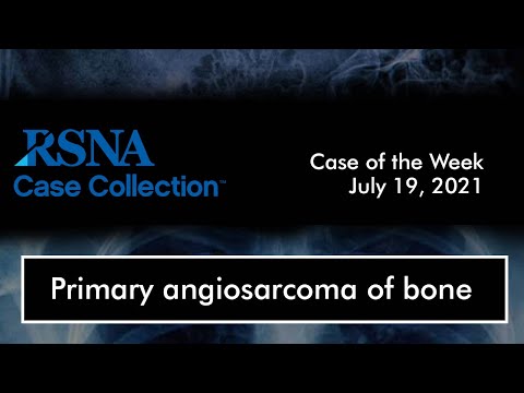 Case of the Week: Primary angiosarcoma of bone