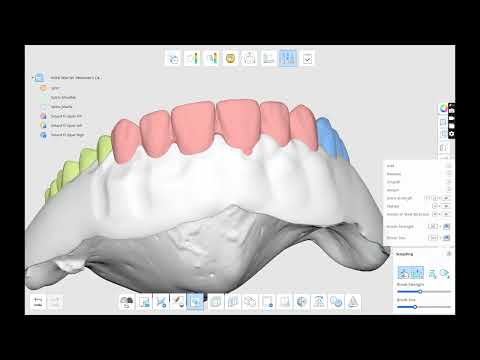 Denture Creation in Medit