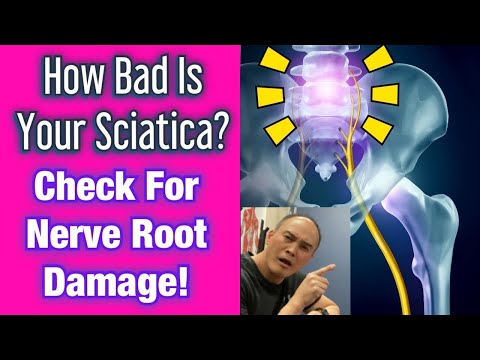 How BAD Is Your SCIATICA? Check For Nerve Root Damage! | Dr Wil & Dr K