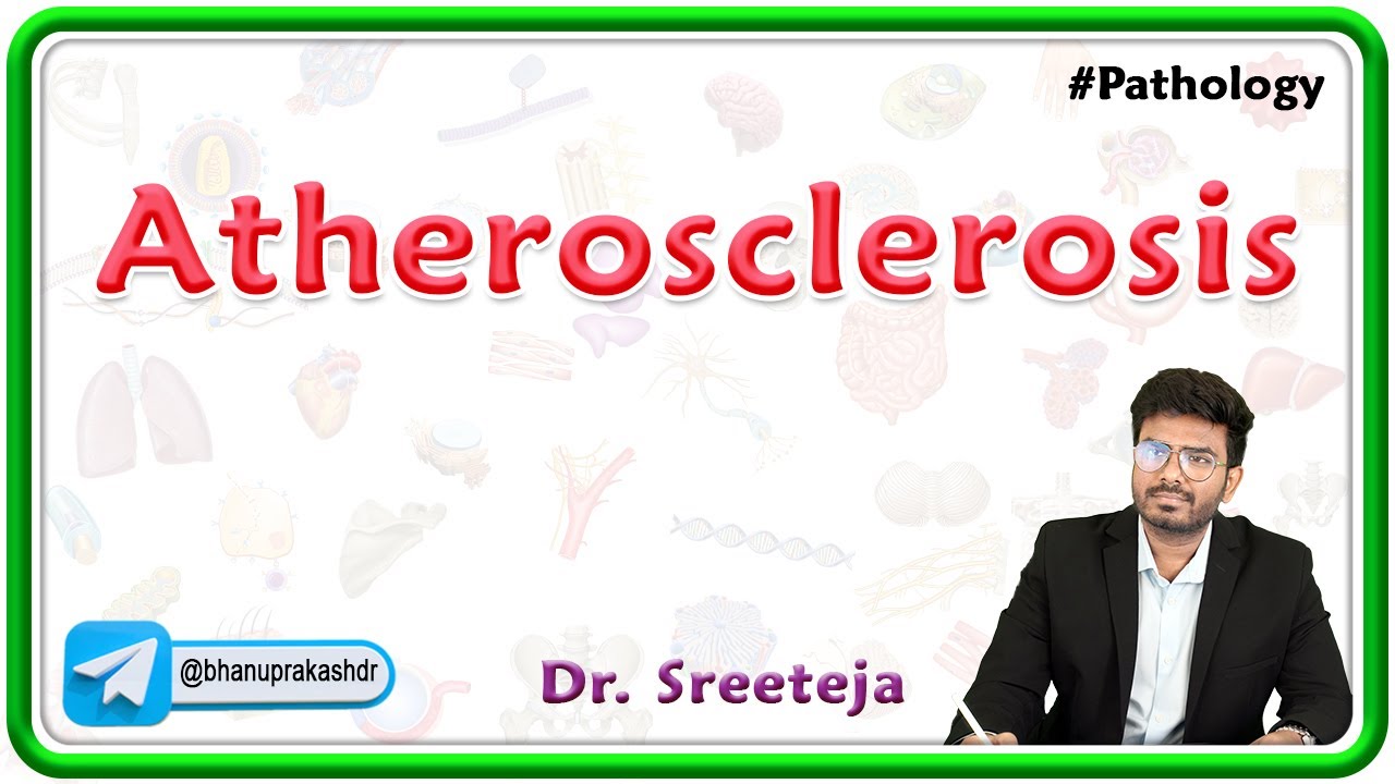 3: Atherosclerosis | Pathology USMLE Step 1