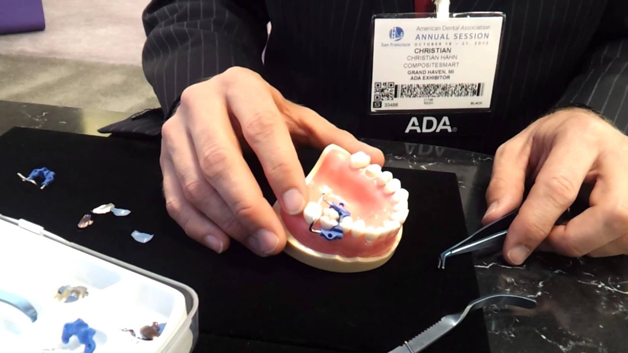Dr. Christian Hahn Explains the SmartView Matrix System