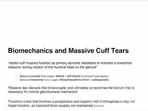 Dr Stewart Morrison - Massive Rotator Cuff Tears
