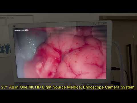 27 Inch All in One 4K HD LED Cold Light Source Video Medical Endoscope Camera System