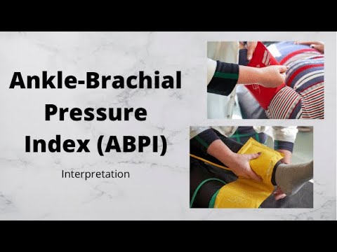 Ankle - Brachial Pressure Index (ABPI) Interpretation | Dr. Muhammad