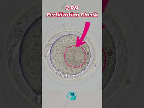 What is ICSI? Step-by-Step Fertility Procedure Explained by an Embryologist