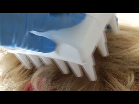 Health Check: Minnesota combats “super-lice”