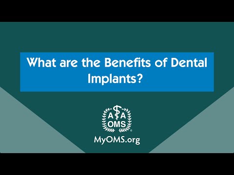 What are the Benefits of Dental Implants?