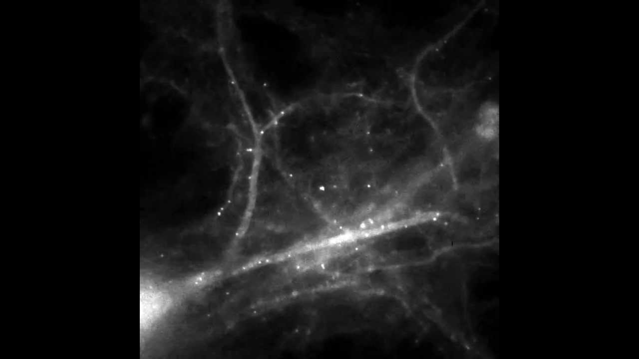 Imaging the Brain While Forming Memories