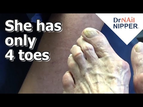 Unbelievable! She has only 4 toes.  FEET-ure Friday  (2023)