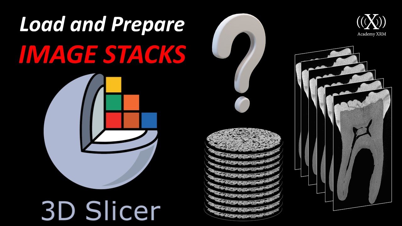 How to Import and Treat Image Stacks in 3D Slicer.