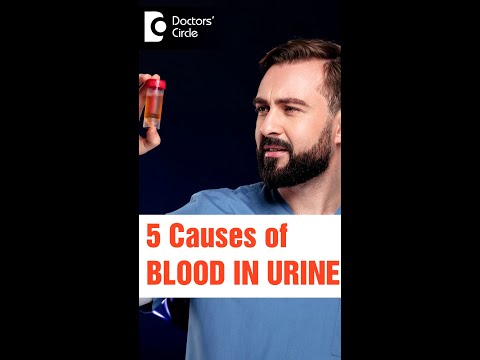 5 Causes Of Blood In Urine #shorts #expertskisuno - Dr. Surekha Tiwari | Doctors' Circle