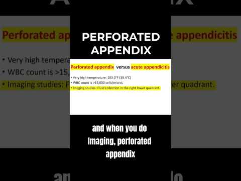 Perforated Appendicitis: The Silent Killer - MCCQE1