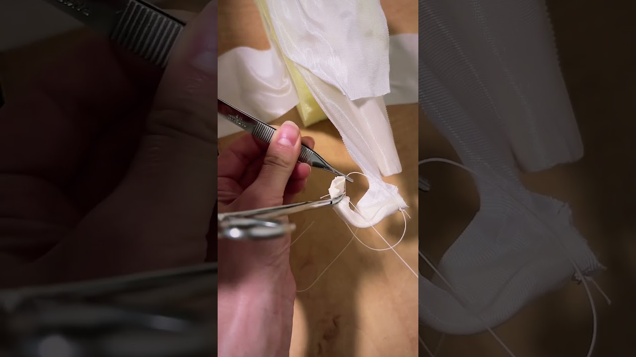 Hysterectomy pedicle fixation stitch! #obgyn #or #surgeon #operatingroom #suture #gynecologist