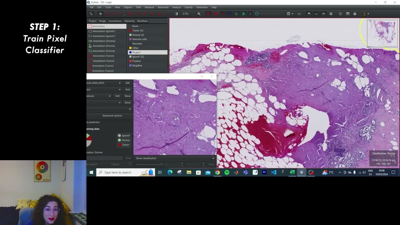 Pixel classification with QuPath