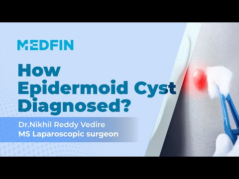 Understanding Epidermoid Cysts: Causes, Symptoms, and Treatment Options