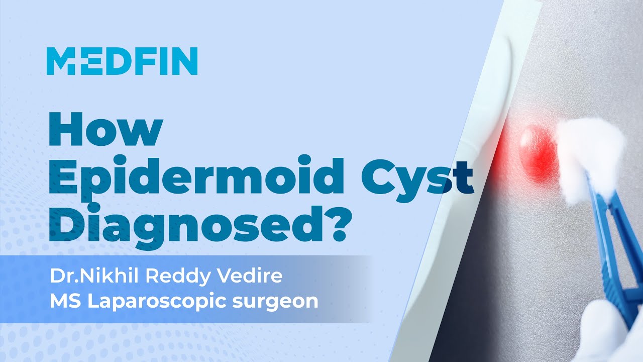 Understanding Epidermoid Cysts: Causes, Symptoms, and Treatment Options