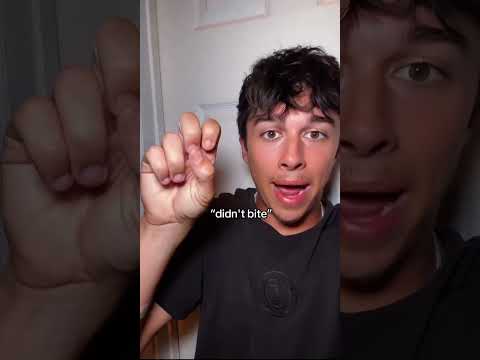 I genuinely regret doing this #relatablestories #comedy #funnymemes