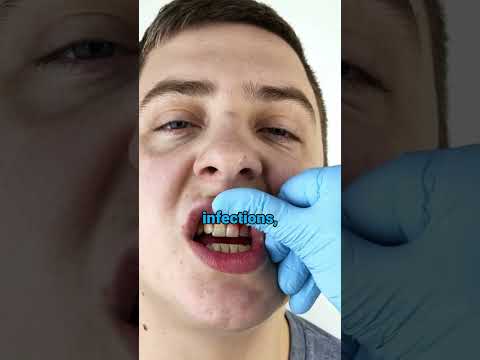 What Causes a Bitter Taste in your Mouth?