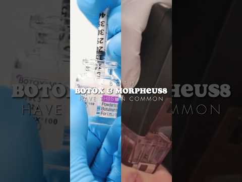 Botox & Morpheus to Address Excessive Sweating #hyperhidrosis #nonsurgical #botox #morpheus8