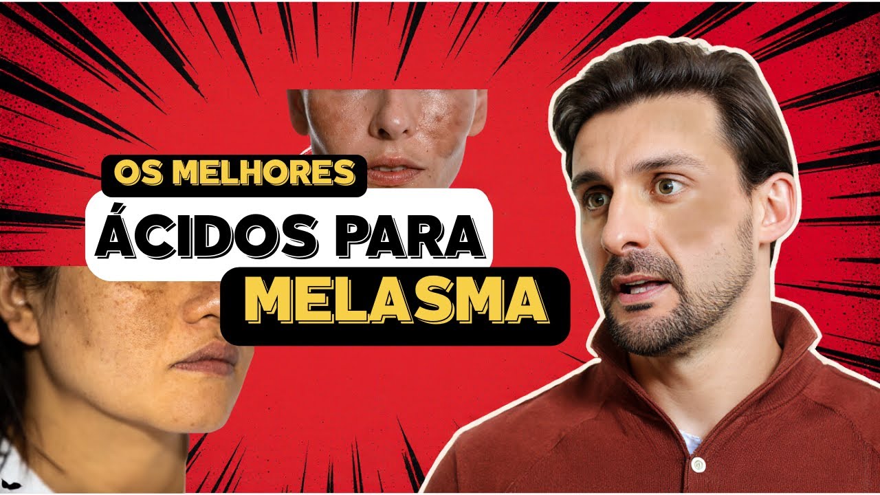 Como tratar melasma?! | Dr. João Tassinary