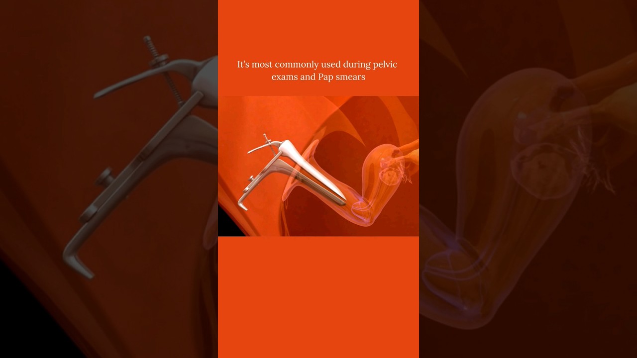 Cusco's Speculum 🤔 #share #foryou