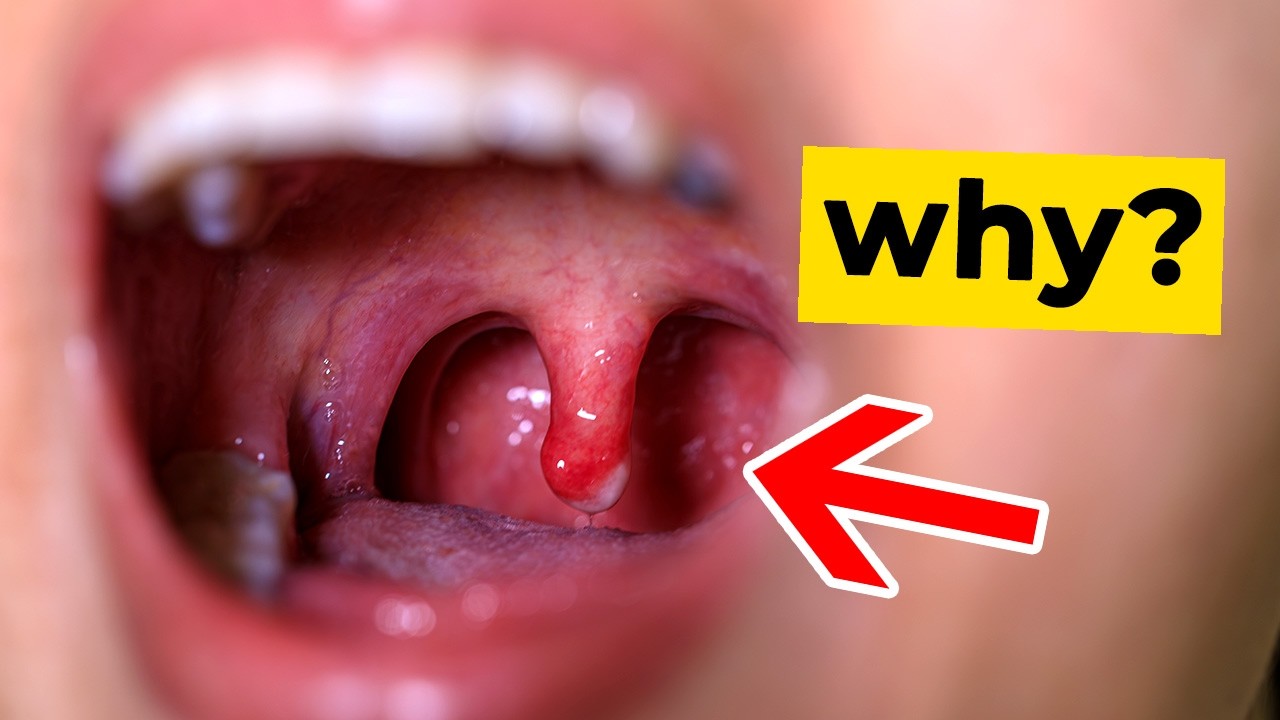Why Do We Have These Things? (Uvula Explained)