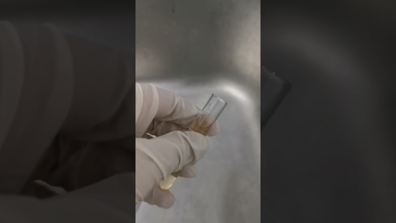 Amorphous Crystals under the microscope #laboratory #medtechstudent #mls #cls #urinesediment #urine