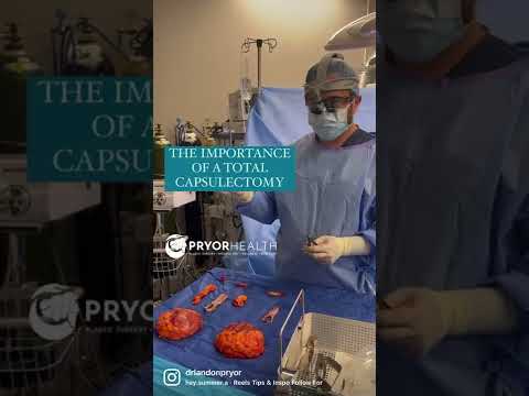 Top Explant Surgeon Dr. Landon Pryor at PryorHealth in Rockford, IL