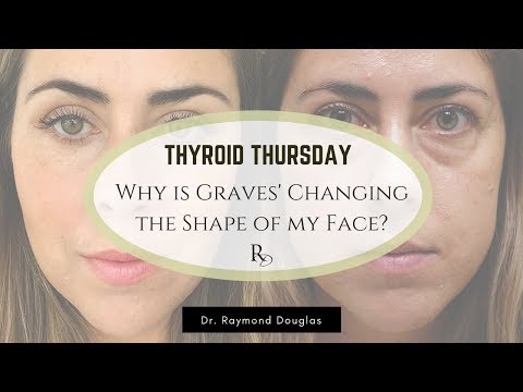 Why Is Graves' Disease Changing The Shape Of My Face? | Dr. Raymond Douglas