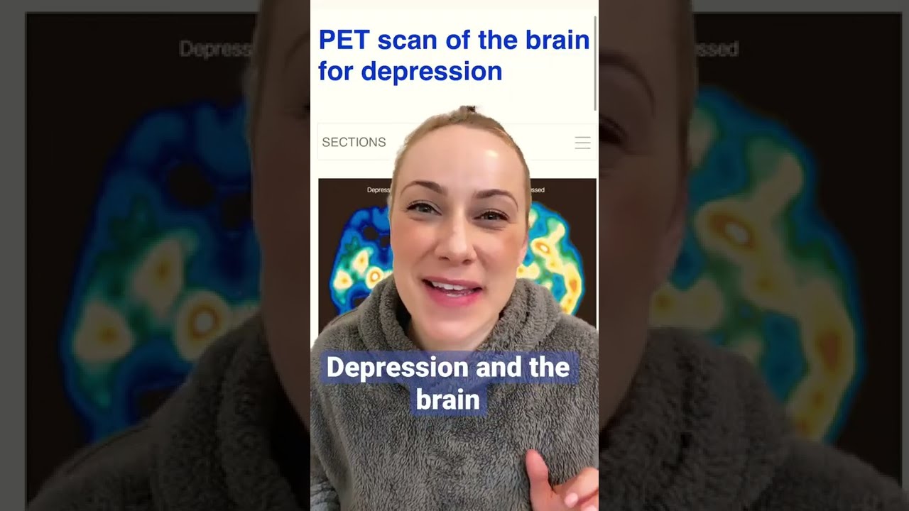 Can you see depression in the brain?