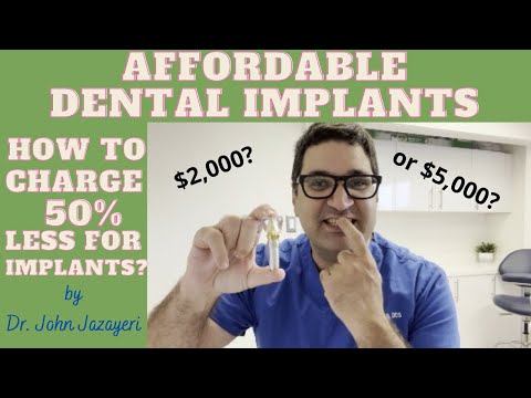 Affordable Dental Implants: The Secrets to Doing Implants For 50% Less?