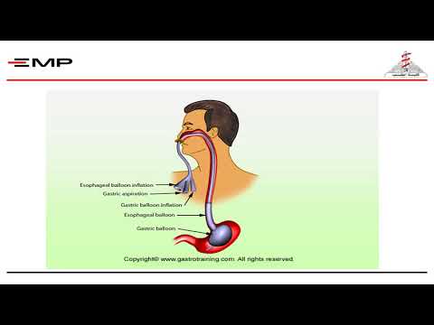 Oesophageal varices