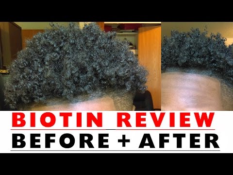 BIOTIN Hair Growth Results Before and After
