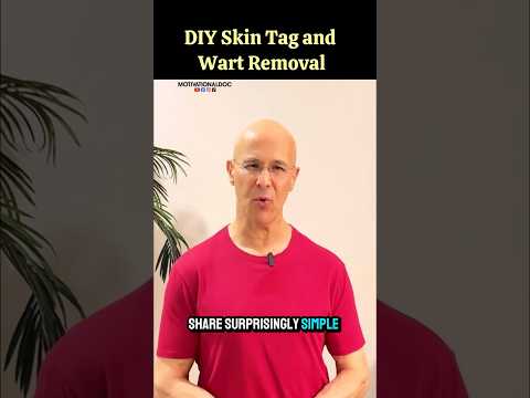 DIY Skin Tag and Wart Removal! #drmandell #skintag #wart #health